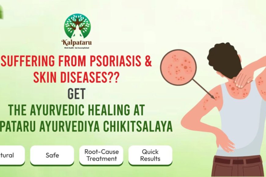 Psoriasis and Skin Diseases – The Ayurvedic Approach at Kalpataru ...