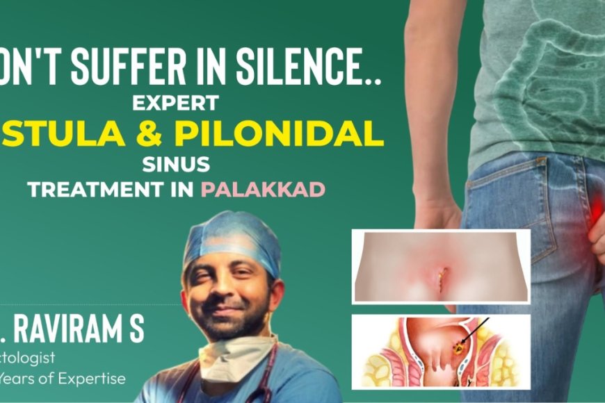 Advanced Treatment for Fistula and Pilonidal Sinus Now Accessible for ...